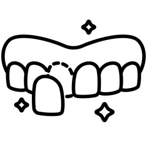 Full Bony Impacted Wisdom Teeth - An Overview - Best Dental