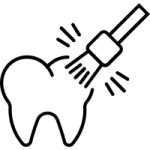 Full Bony Impacted Wisdom Teeth - An Overview - Best Dental