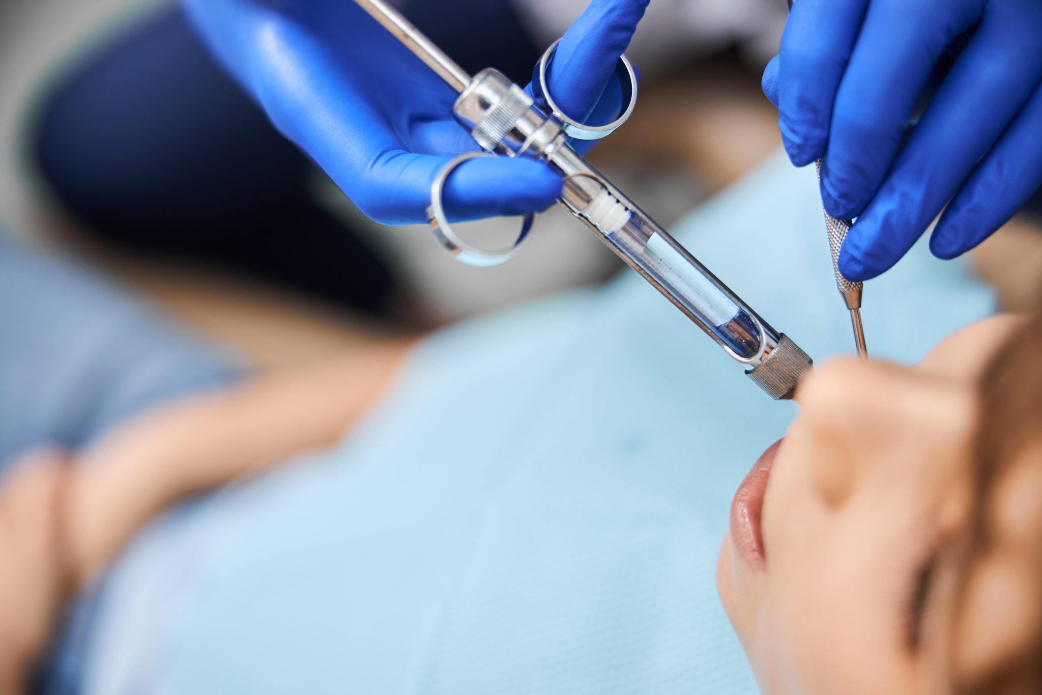 Tooth Extraction Cost Houston - Best Dental