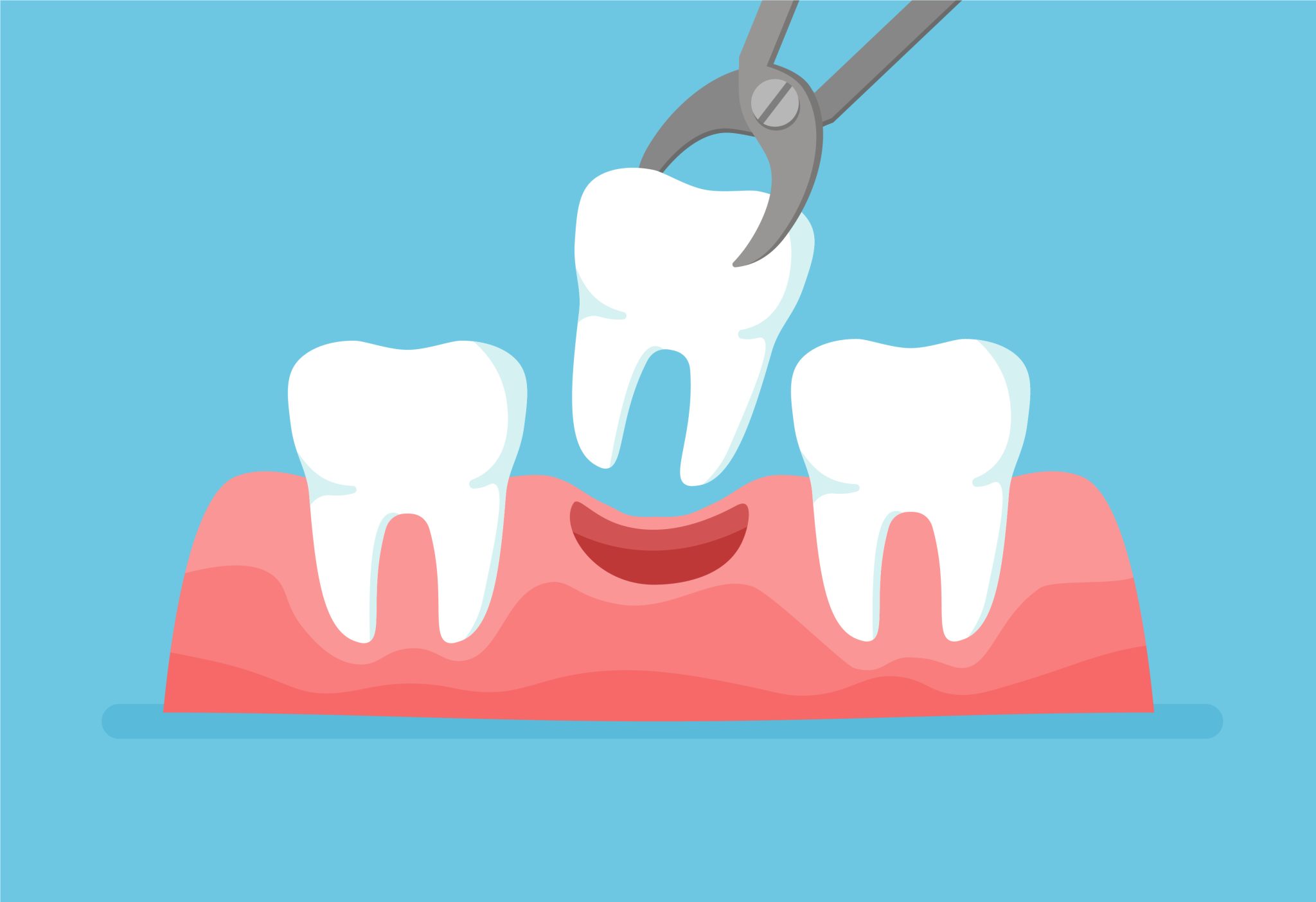 How Painful is a Tooth Extraction? - Best Dental