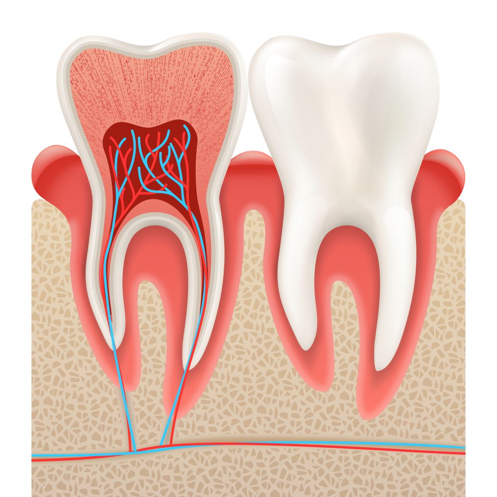 Root Canal on Wisdom Teeth - Best Dental