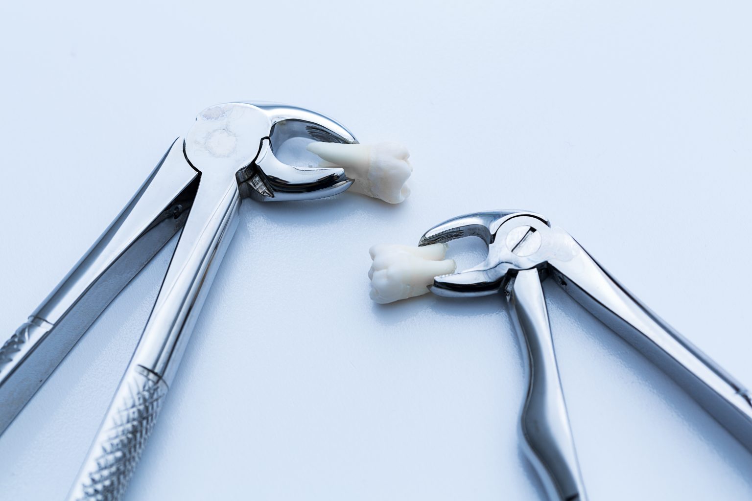 How Painful is a Tooth Extraction? - Best Dental